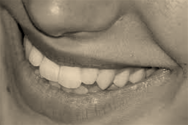 ORTHOTROPIE - Comment être visuellement plus attractif.ve